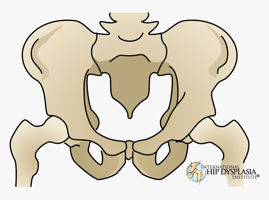 Ganz Osteotomy, HD Png Download , Transparent Png Image - PNGitem