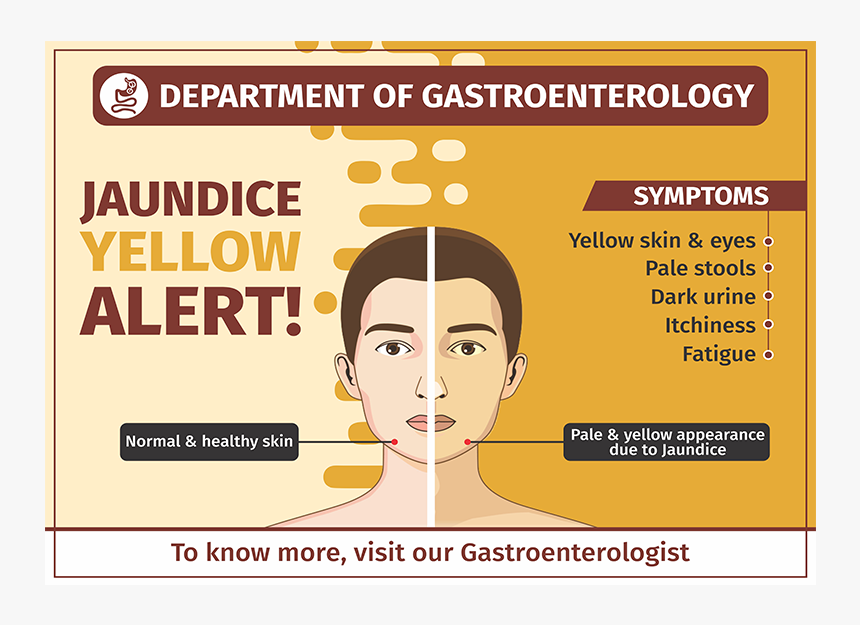 Gastroenterology Jaundice - Poster, HD Png Download , Transparent Png ...