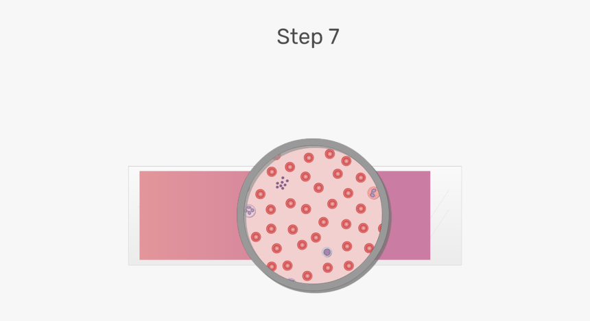 Animation Of Blood Cell Being Examined Under Microscope - Blood Smear ...
