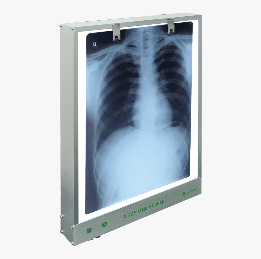 Single Sided Led X Ray Viewer Style Max Height - X Ray Film Viewer, HD ...