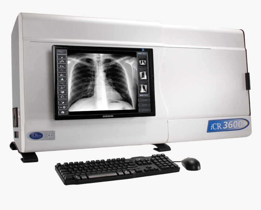 Digital X Ray - Cr X Ray Machine, HD Png Download , Transparent Png ...