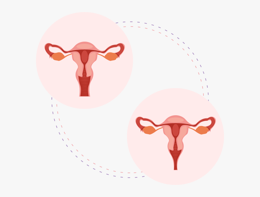 Vaginal Laxity - Labelled Female Reproductive System Diagram Simple, HD ...