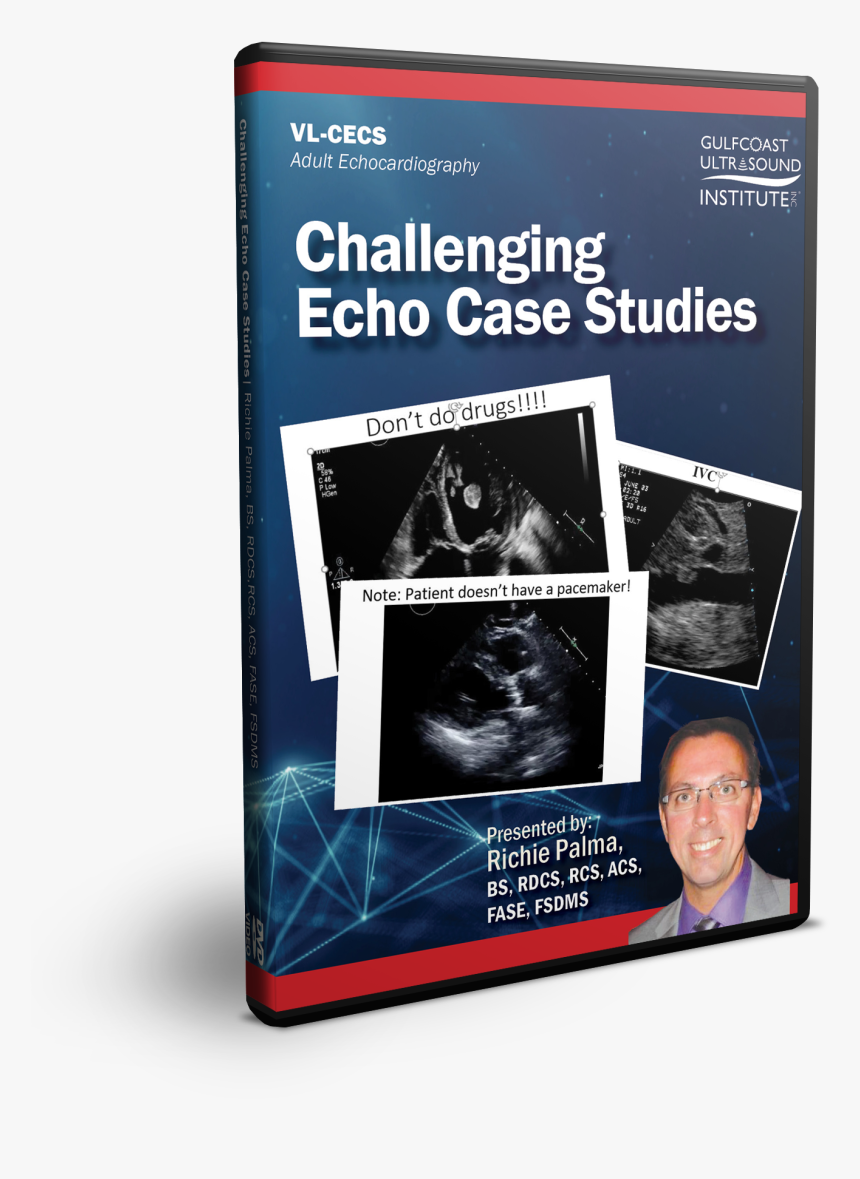 Challenging Echo Case Studies - Novel, HD Png Download , Transparent ...