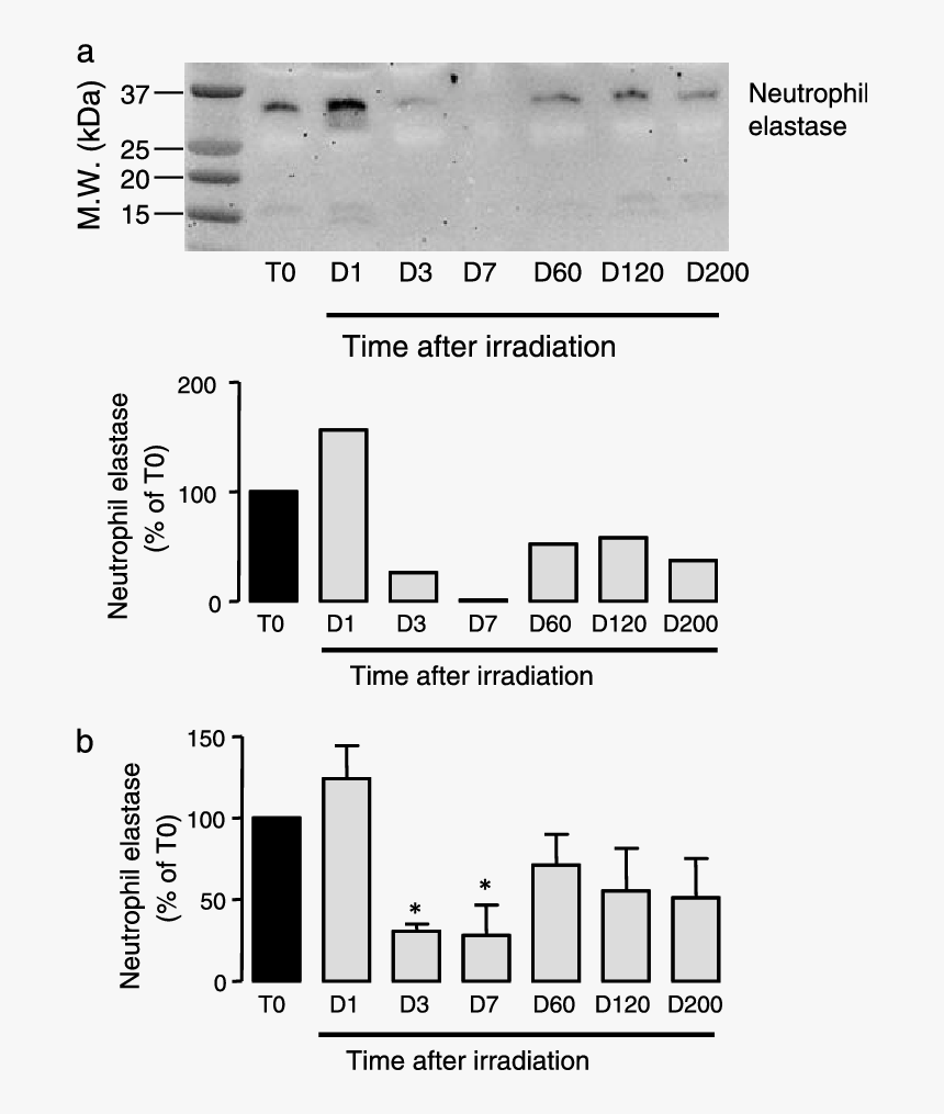 Neutrophil Elastase Nets Western Blot, HD Png Download , Transparent ...