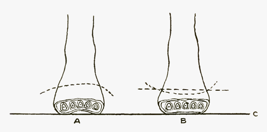 Foot Care And Shoe Fitting-fig5 Cross Section Of Feet - Metatarsal ...