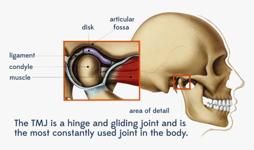 Tmj Lancashire Dental - Do Braces Cause Tmj, HD Png Download ...