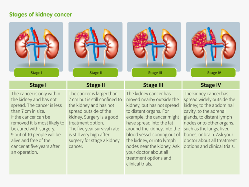 Kidney Tumor Stages, HD Png Download , Transparent Png Image - PNGitem