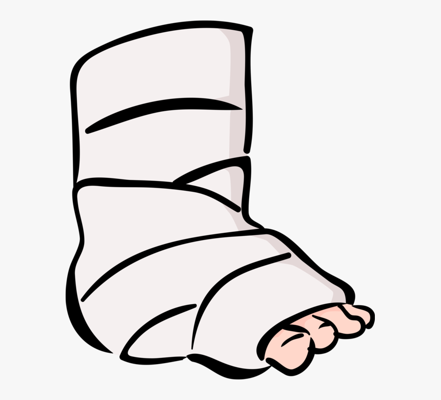 Broken Legs Png, Picture, Transparent Png , Transparent Png Image - PNGitem