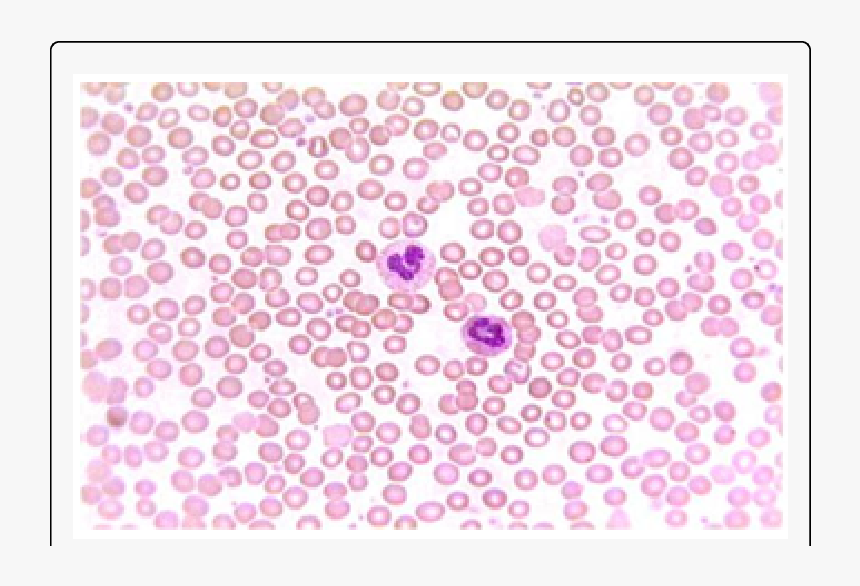 Blood Smear Png, Transparent Png , Transparent Png Image - PNGitem