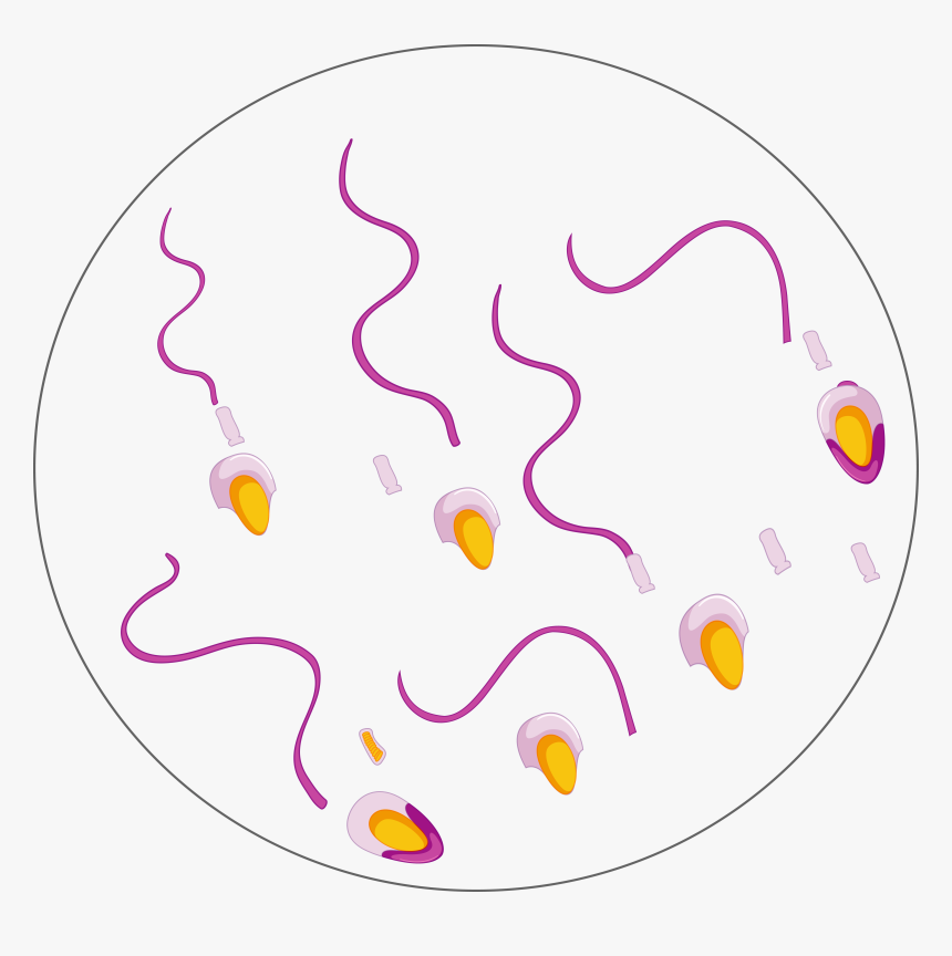 Azoospermia, HD Png Download , Transparent Png Image - PNGitem