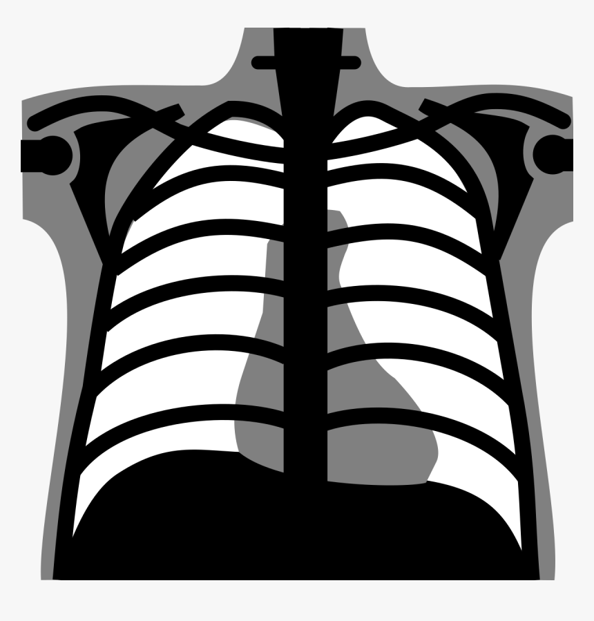 X-rays Chest Icon - Chest X Ray Vector, HD Png Download , Transparent ...