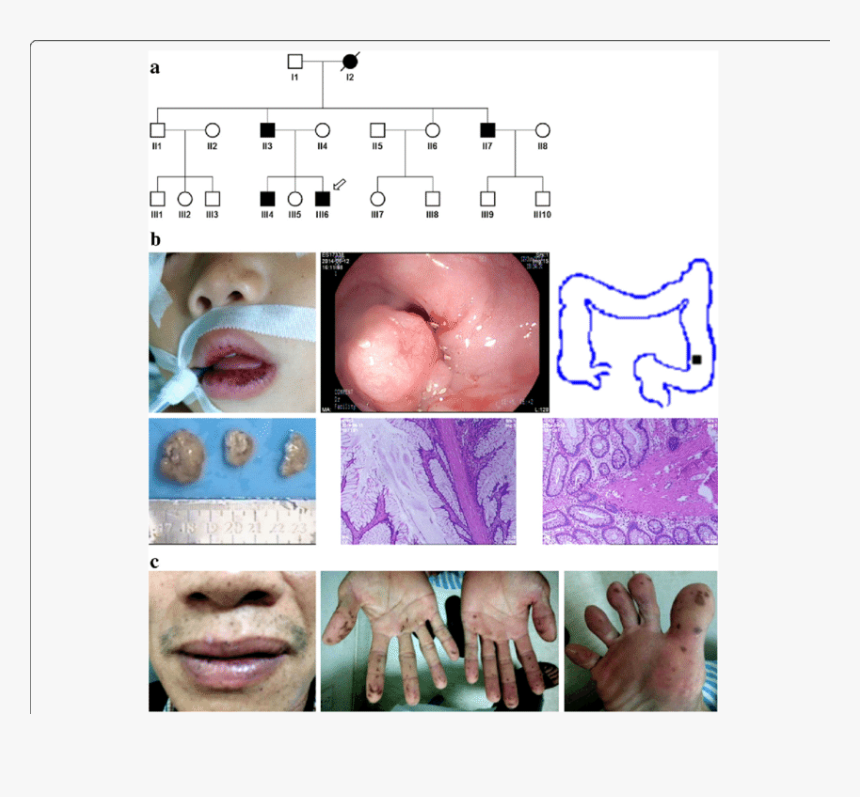 Tongue, HD Png Download , Transparent Png Image - PNGitem