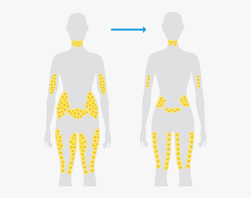 Transparent Fat Man Png, Png Download , Transparent Png Image - PNGitem