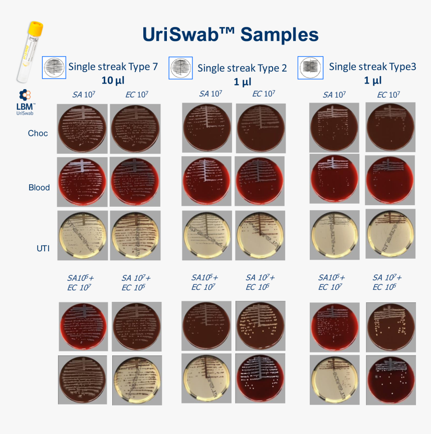 Types Of Streaking Patterns , Png Download, Transparent Png ...
