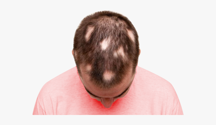 Hair Wigs For Men Png, Transparent Png , Transparent Png Image - PNGitem