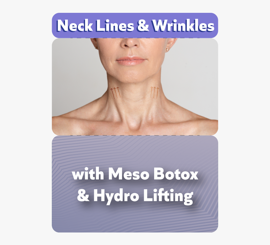 Neck Lines And Wrinkles, HD Png Download , Transparent Png Image - PNGitem