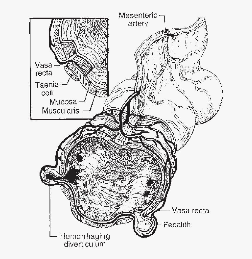 Cross Section Of Colon - Cross Section View Of Taenia Coli, HD Png ...