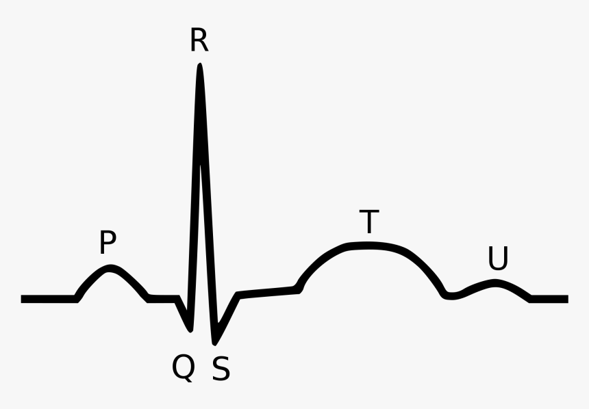 Qrs Complex, HD Png Download , Transparent Png Image - PNGitem